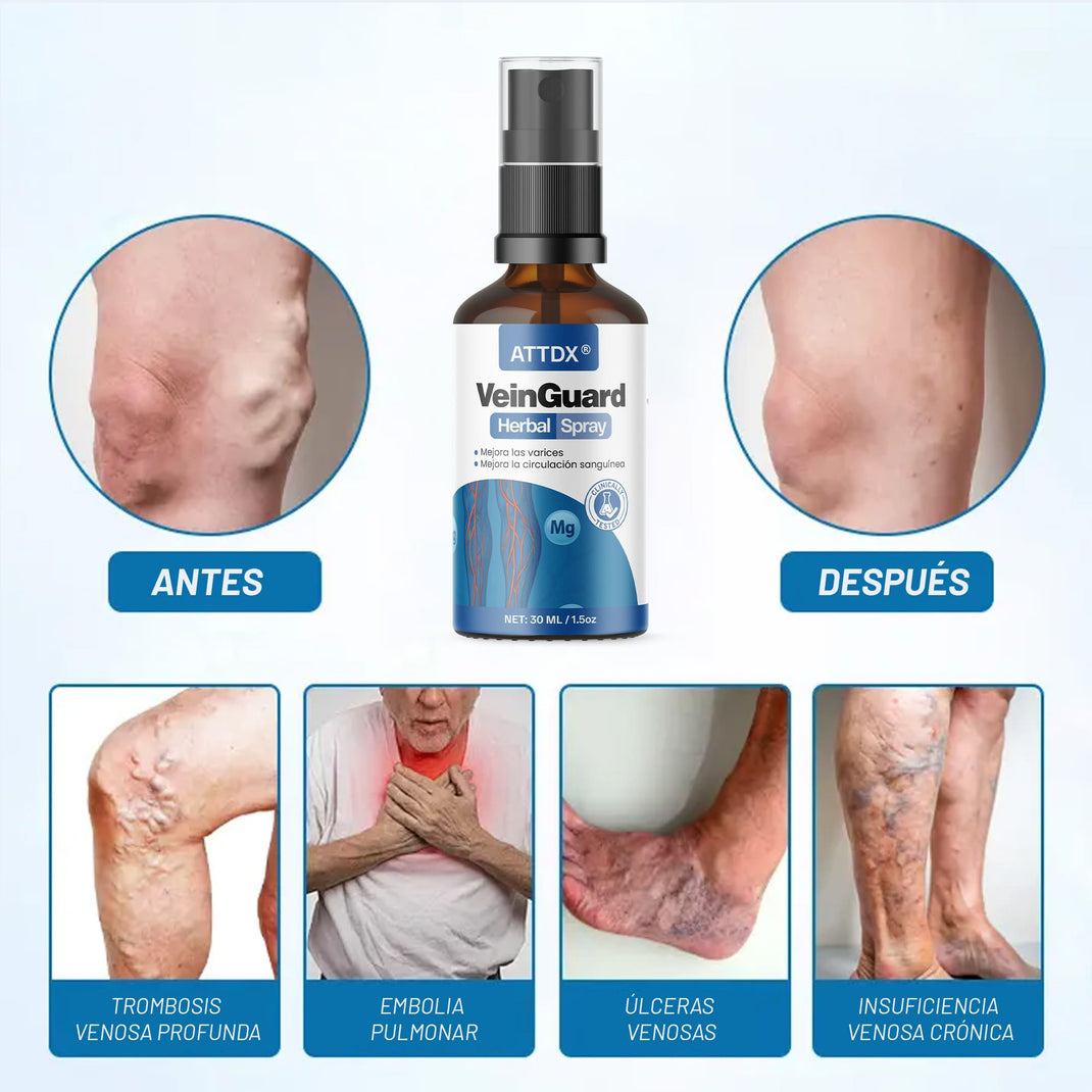 VEINGUARD Herbal Spray: Desinflama y Mejora las Varices y las Arañitas ...